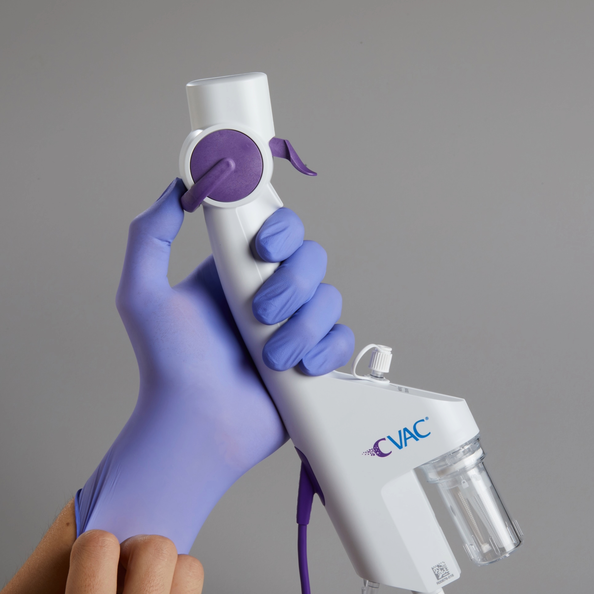 A revolutionary breakthrough in kidney stone removal | Synapse