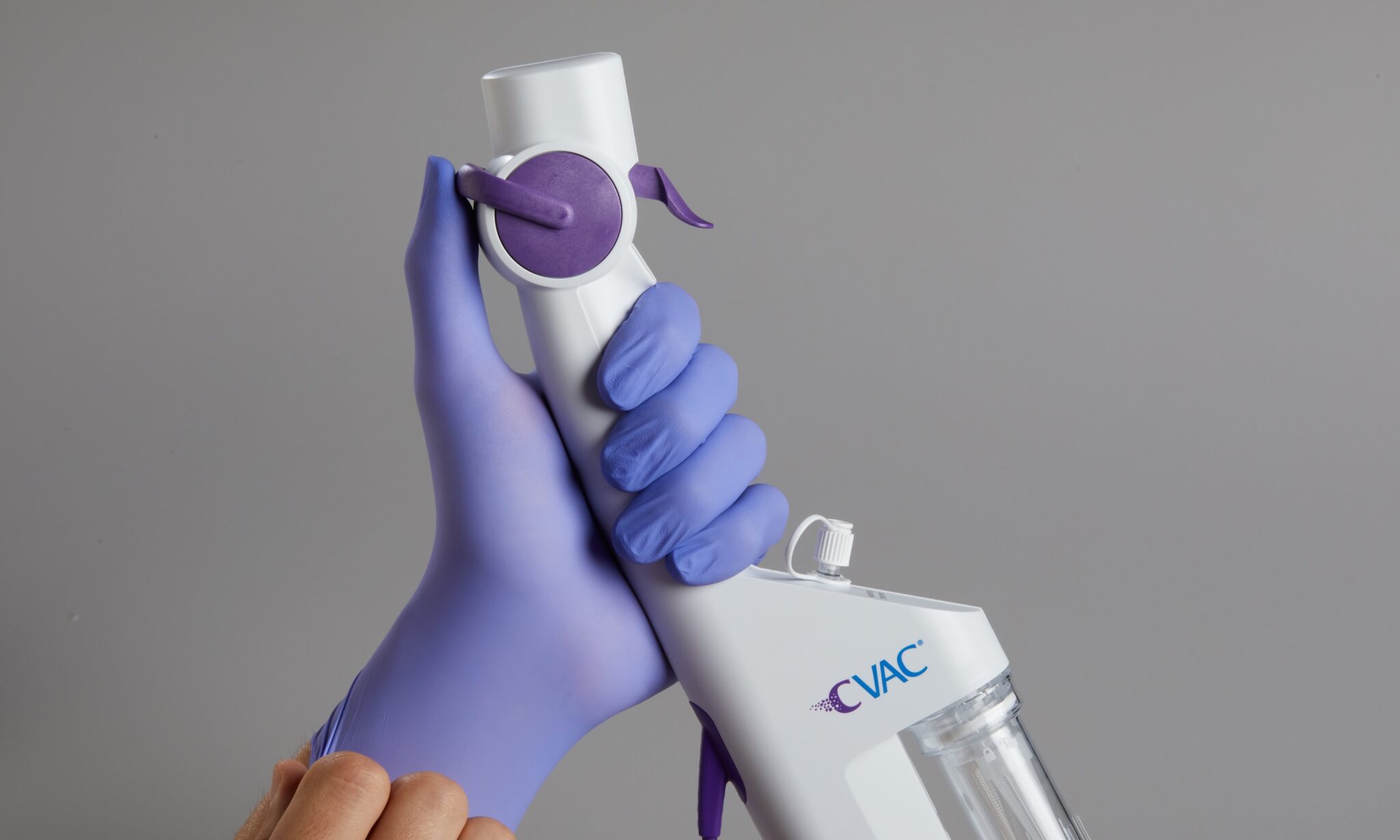 A revolutionary breakthrough in kidney stone removal | Synapse