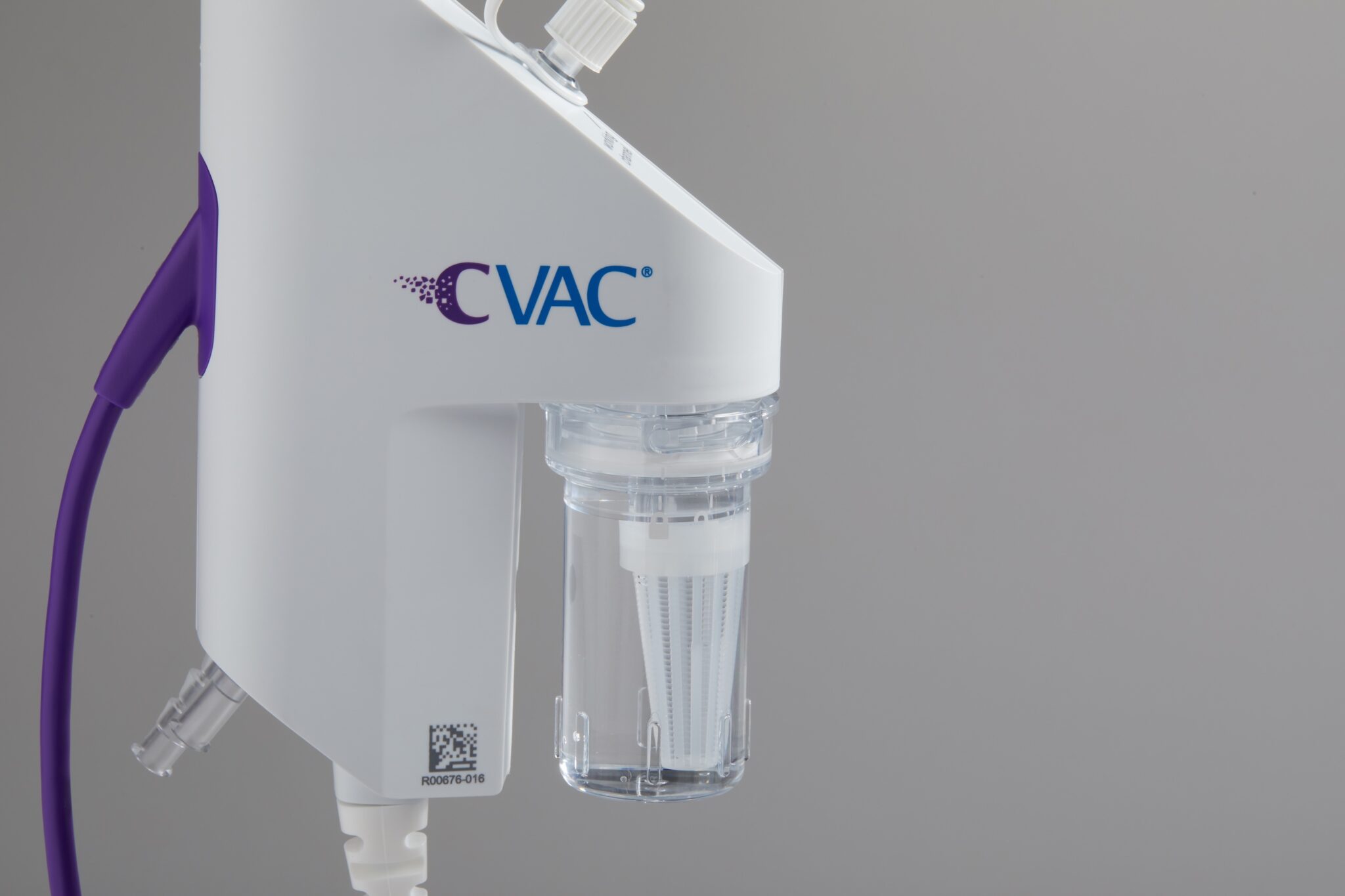 A revolutionary breakthrough in kidney stone removal | Synapse